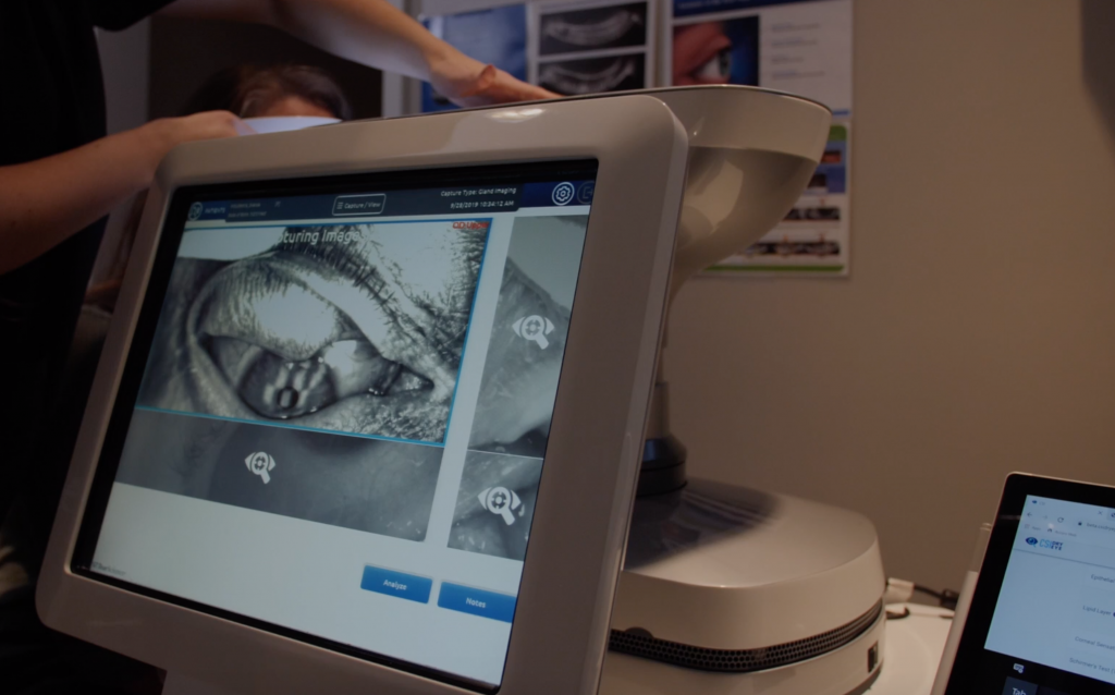 One-of-a-Kind Dry Eye Technology | CSI Dry Eye